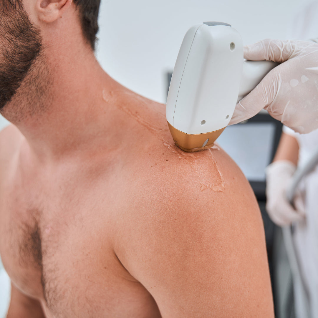 Flawless and Carefree: Lip & Chin Laser Hair Removal – Sechi Academy